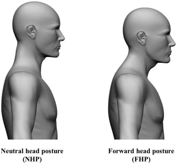 Raideur cervicale et troubles respiratoires
