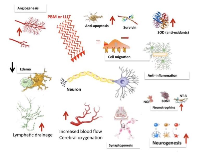 Commotion, traumatisme crânien et photobiomodulation transcrânienne